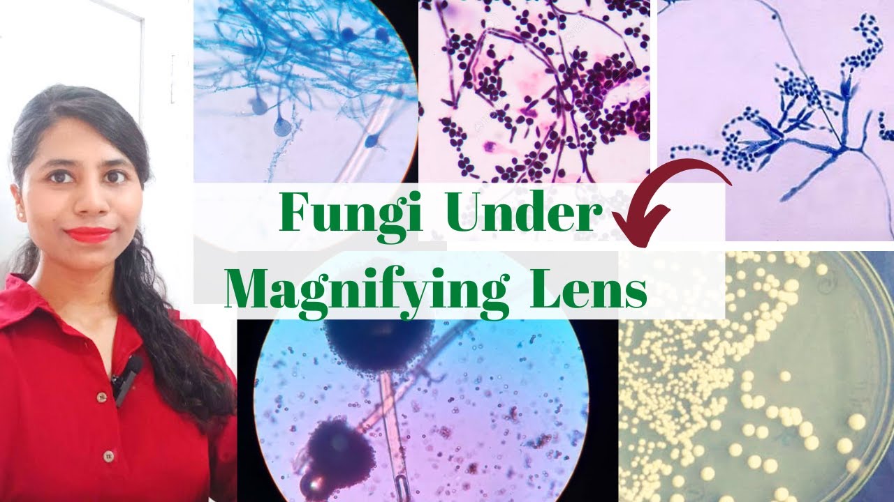 How do you identify fungi under a microscope? | LPCB stain | Do fungi show up on Gram stain ...