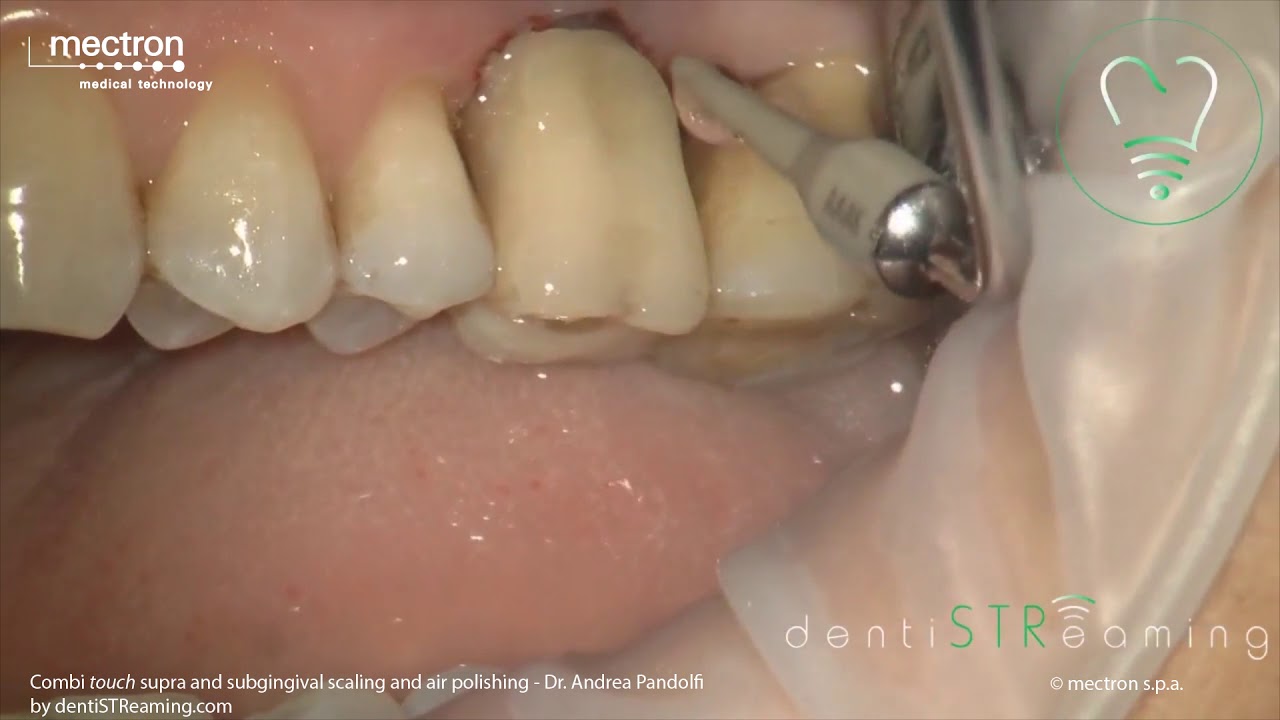 COMBI touch Mectron - YouTube