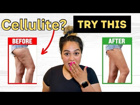 Transform Your Body: 3 Essential Tips for Losing Weight & Fighting ...