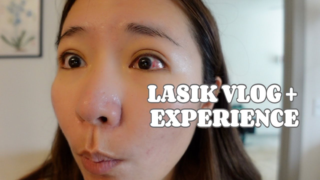 LASIK experience vlog | pain, cost, recovery emilyywang - YouTube