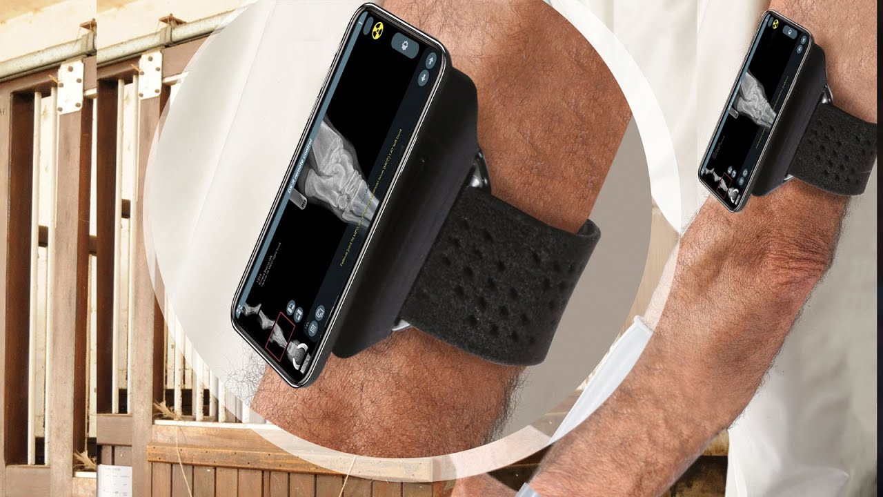 Convenient X-ray with remote control - YouTube