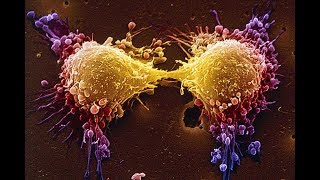 Como o câncer se desenvolve - Patologia I