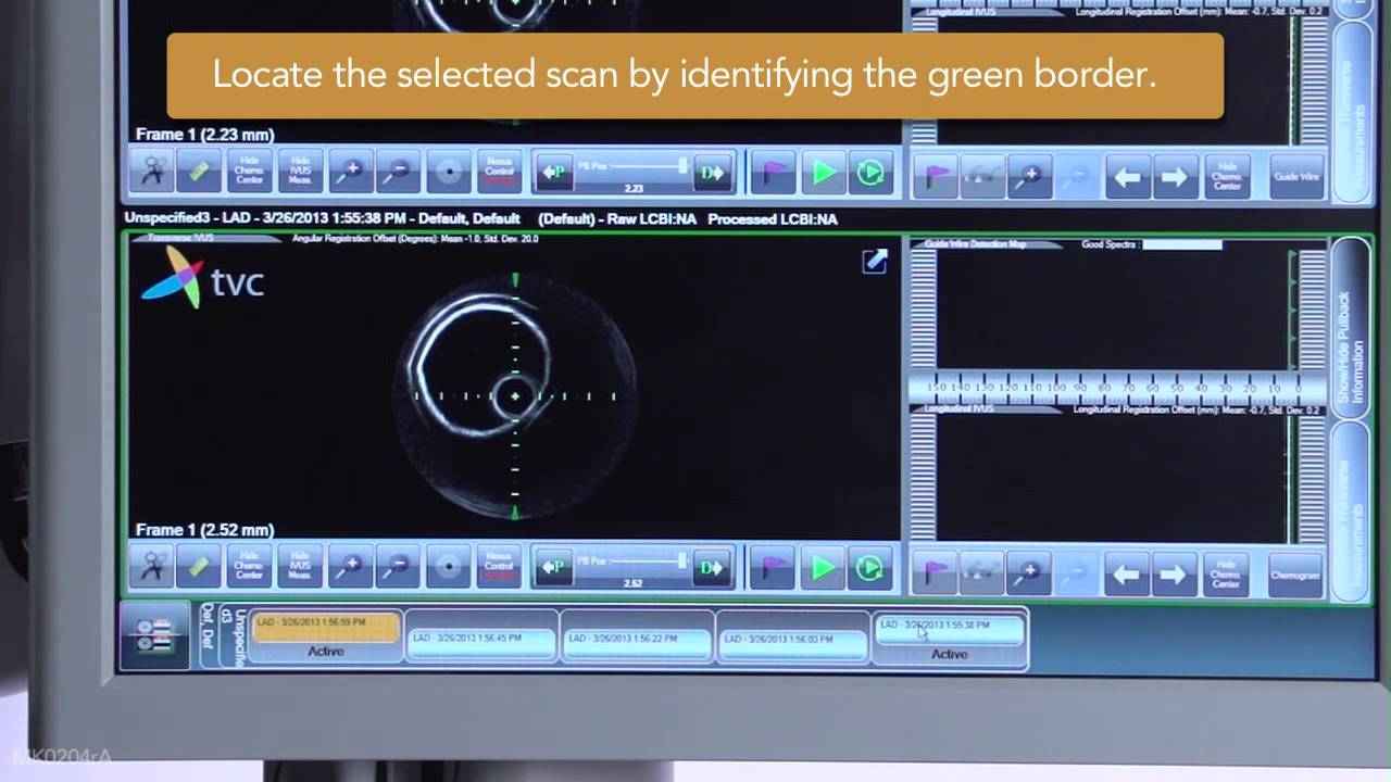 Acquiring an Automated Scan on the TVC Imaging System - YouTube