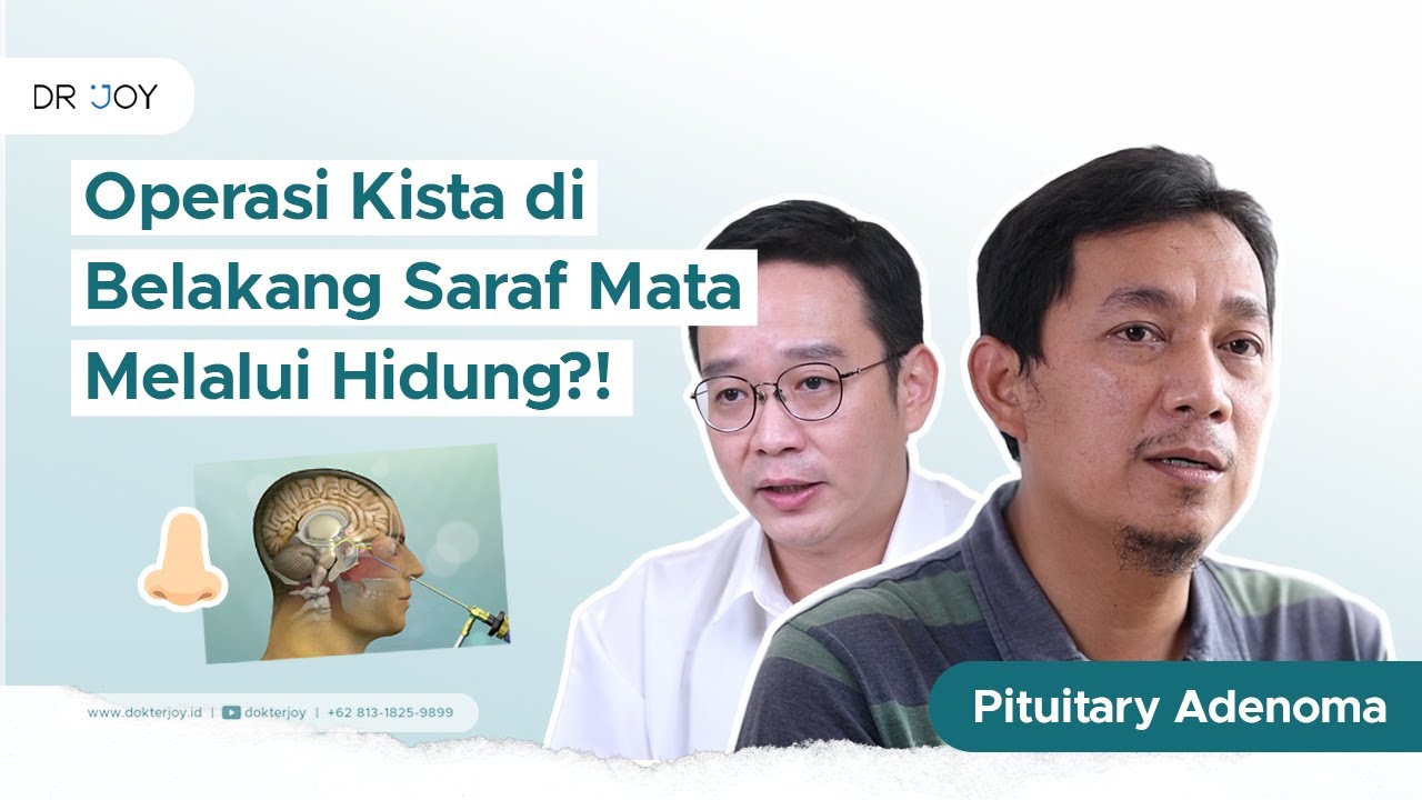 Operasi Kista di Belakang Saraf Mata! | Cerita Tumor Otak #13 - YouTube