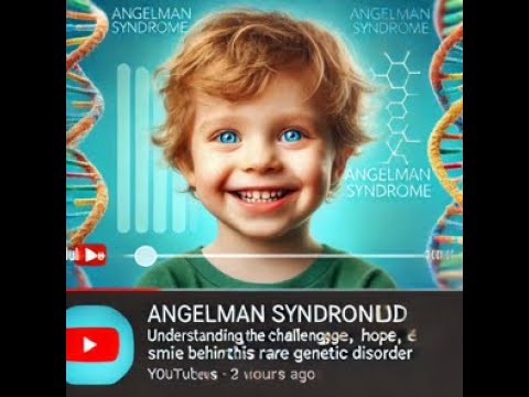 "Angelman Syndrome: Understanding the Challenges, Hope, and Smiles ...