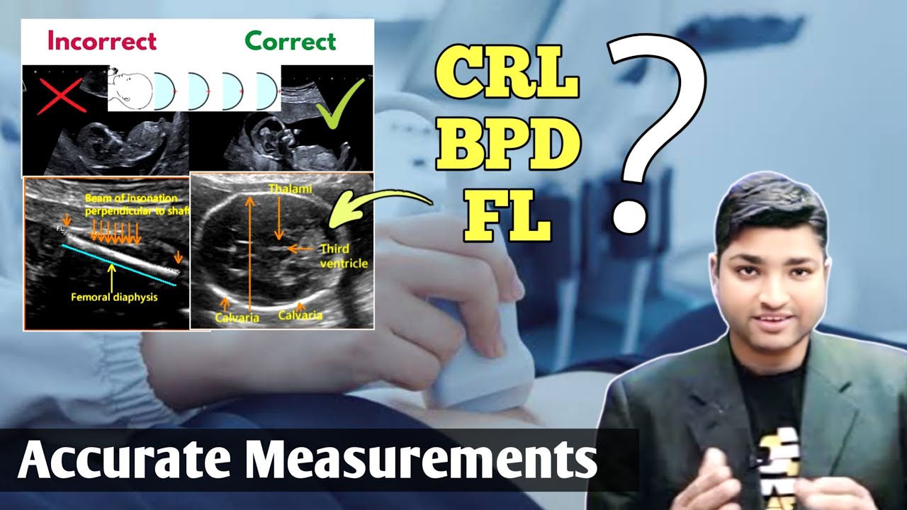 Accurate Measurements of CRL, BPD and FL | Crown Rump Length ...