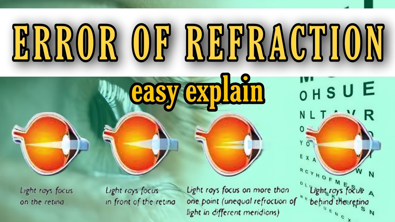error of refraction | refractive error | what is refractive error ...