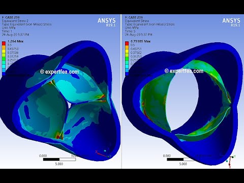 ANSYS WB Static Structural - FEA simulation of the closing and opening of an aortic valve - YouTube