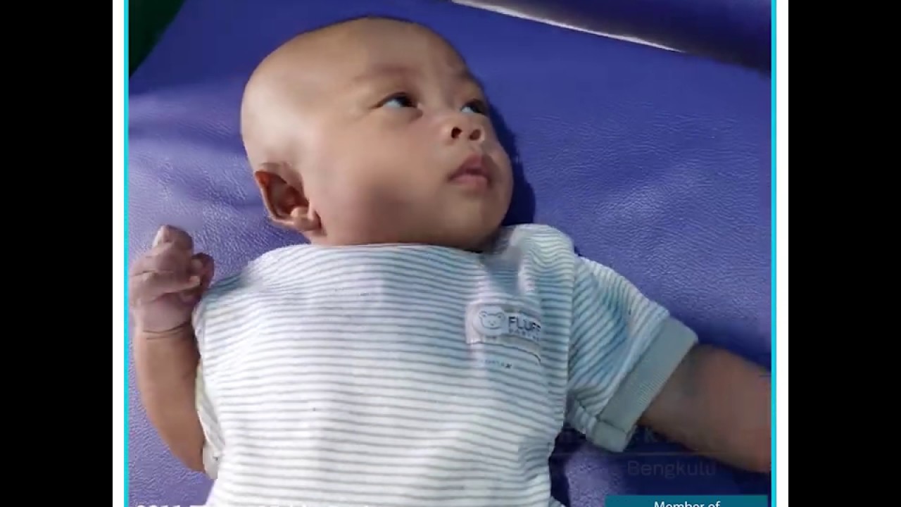 Sunat Bayi Usia 1 Bulan Metode Alisklamp (klamp/klem) - Rumah Sunat ...