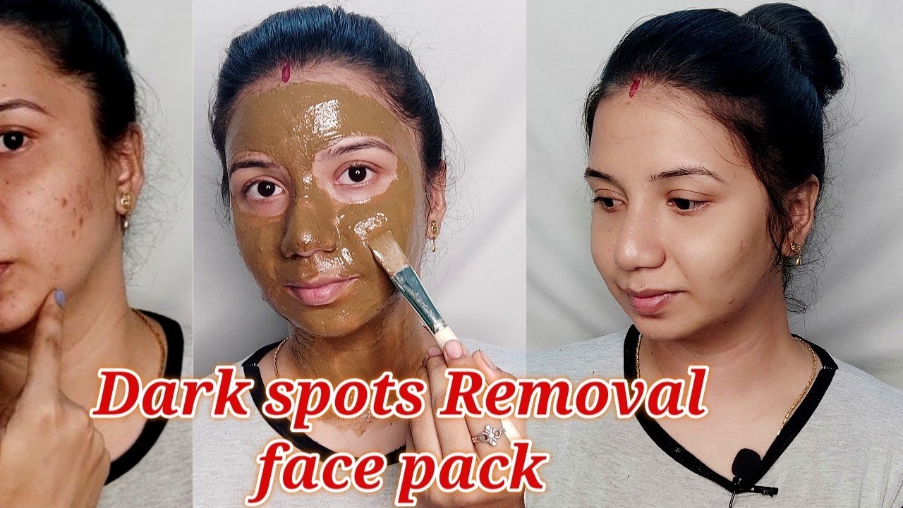 black spot removal facepack using natural ingredients at home | pimple ...