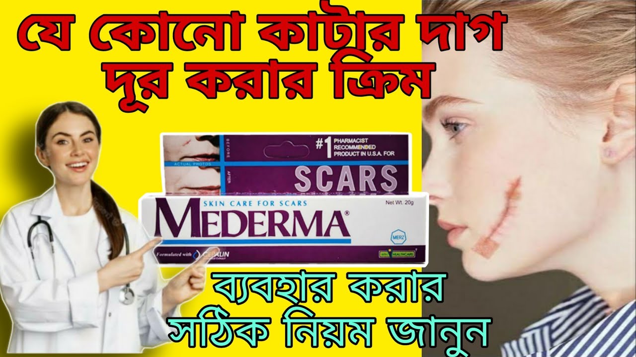 Mederma cream | mederma cream for acne scars | mederma cream review ...