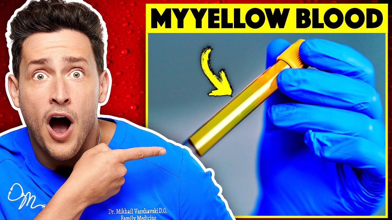Here's Why My Blood Is Actually Yellow - YouTube