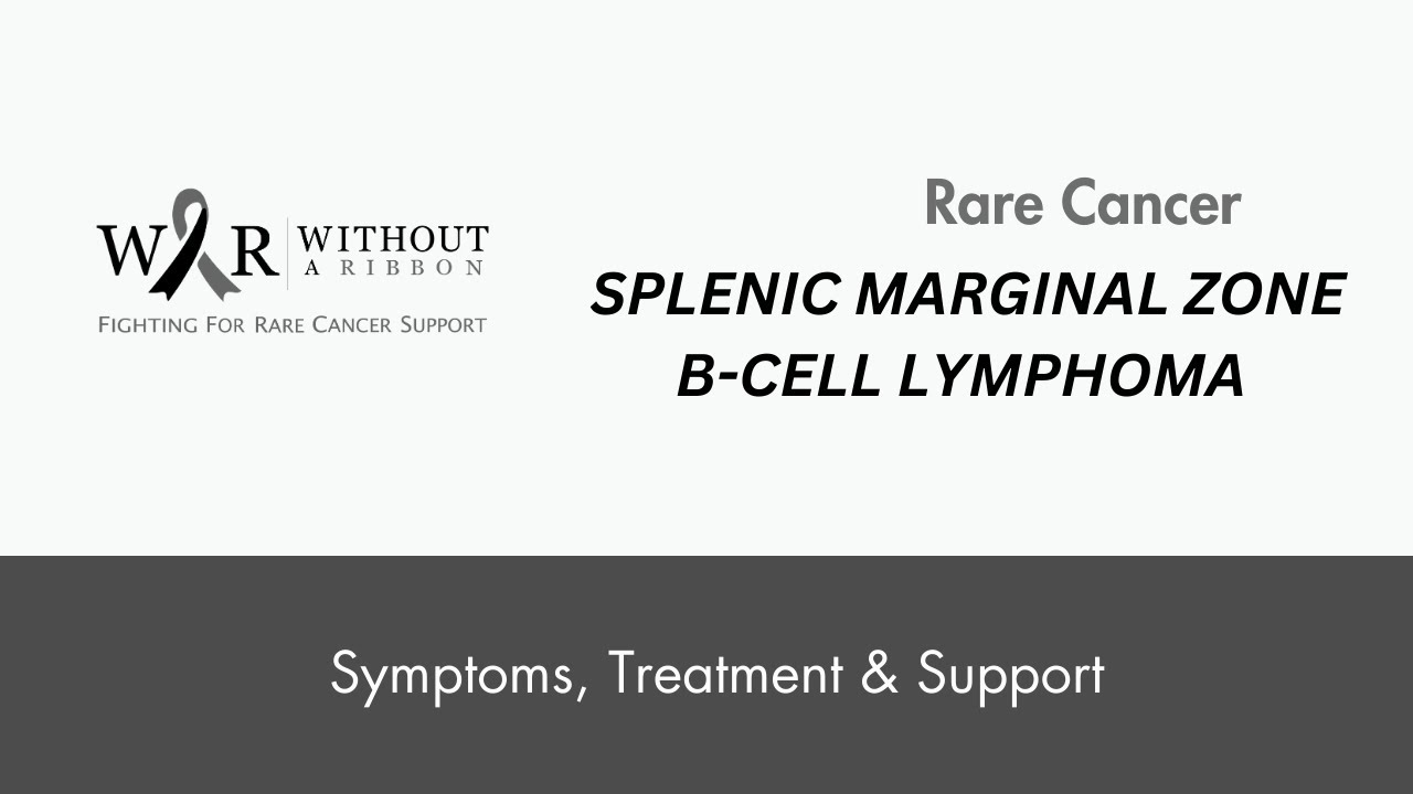SPLENIC MARGINAL ZONE B CELL LYMPHOMA - YouTube