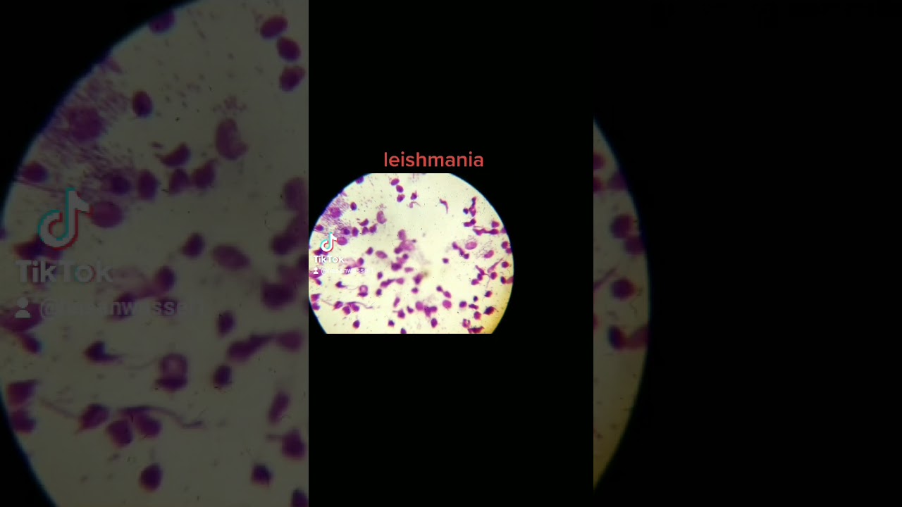 leishmania under microscope. - YouTube