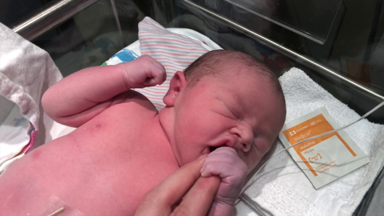 C SECTION BIRTH! - YouTube