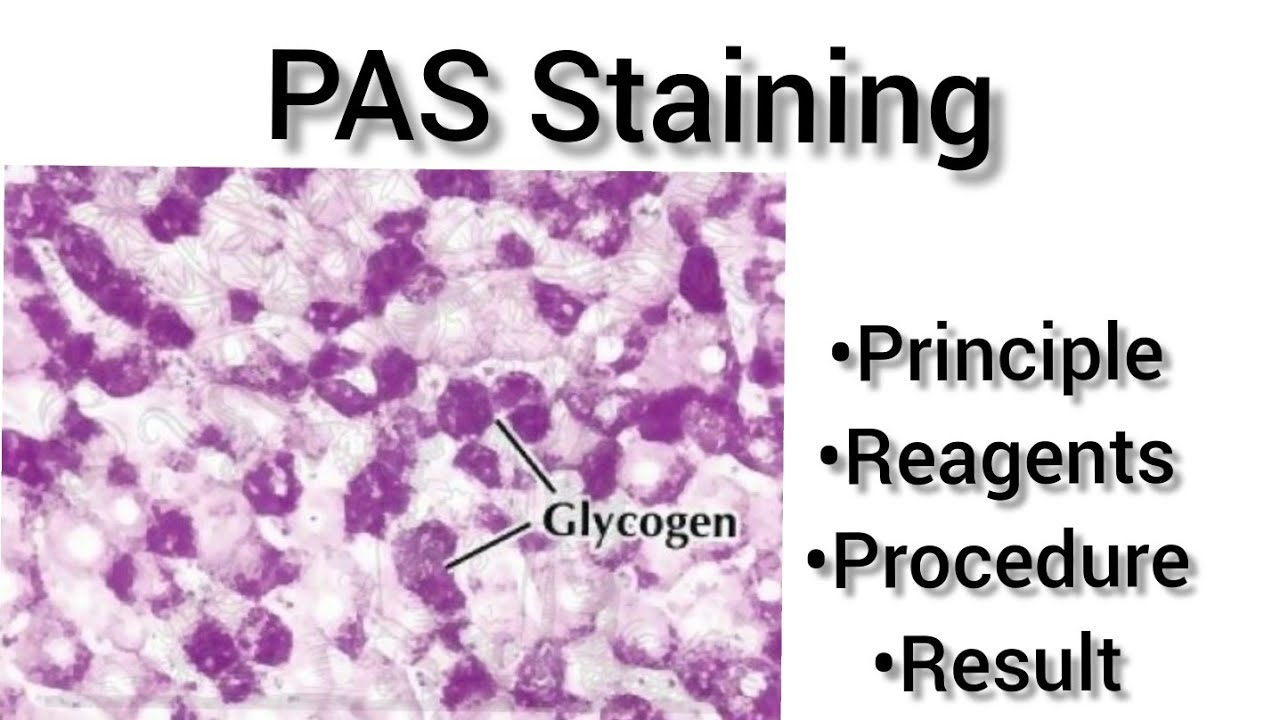 PAS Staining #histopathology #laboratory #medical #paramedical - YouTube