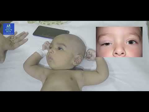 General Physical Examination of an Infant by Prof. Iftikhar Ijaz