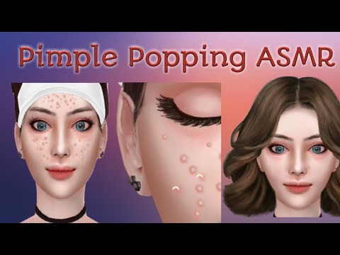 ASMR Pimple popping animation |Pimple kaise sahi karen | #animation # ...