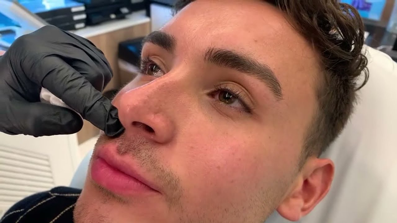 MALE RUSSIAN LIP "KEYHOLE POUT" PLUMPING WITHOUT LOOKING OVERDONE USING ...
