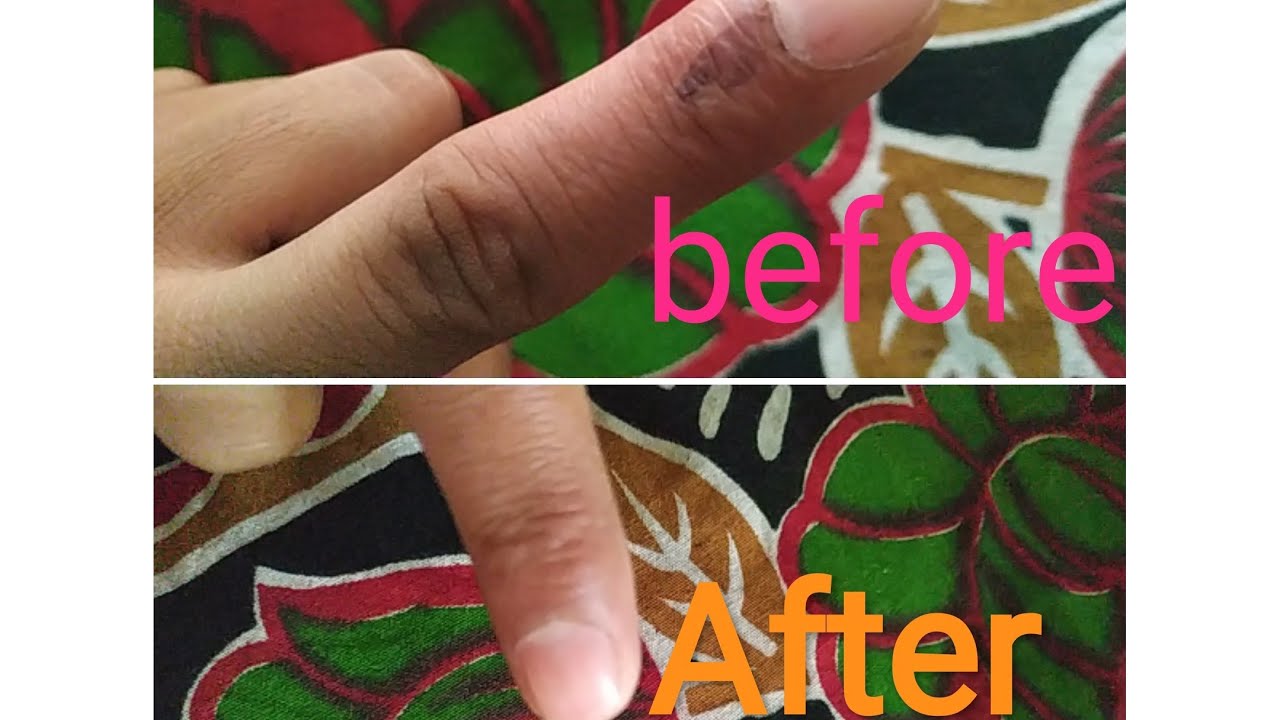 How to remove election voting ink - YouTube