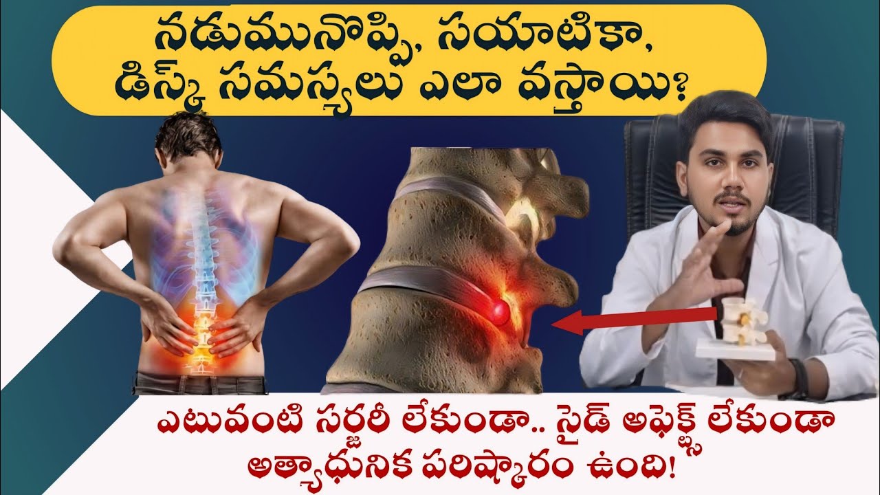 WHAT IS THE REASON FOR BACK PAIN | SCIATICA | DISC PROBLEMS | NON-SURGICAL TREATMENT | #backpain ...