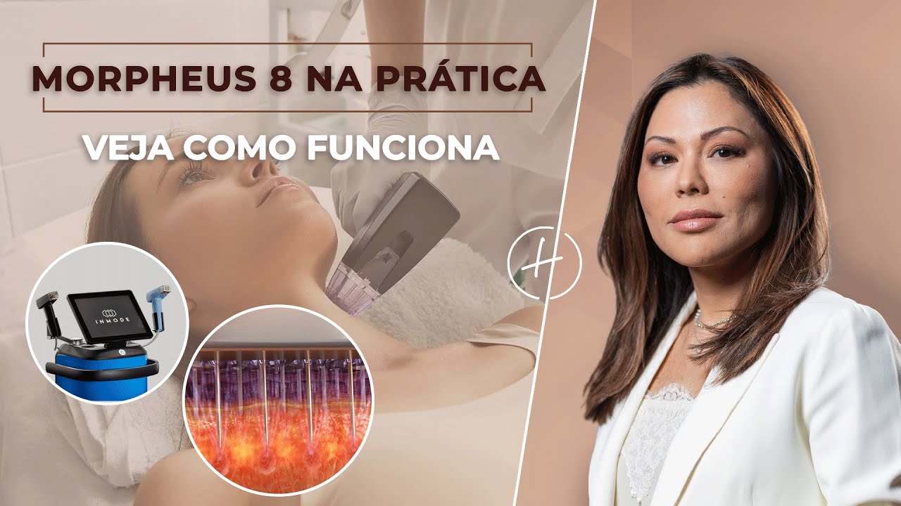 MORPHEUS 8 NA PRÁTICA: VEJA COMO FUNCIONA | LUCIANA HITOMI - YouTube