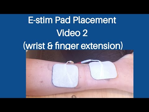 Stroke Recovery- Electrical stimulation pad placement for wrist and ...