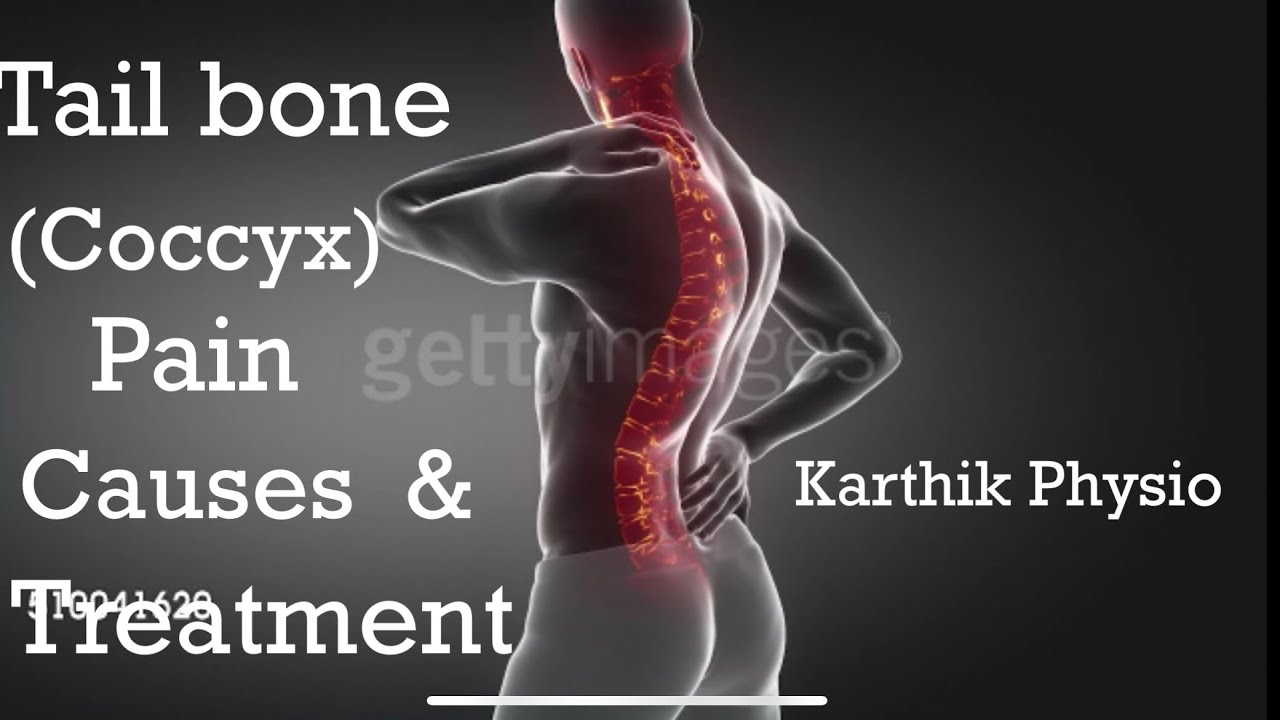 How to treat Tail bone Pain @ Karthik Physio - YouTube