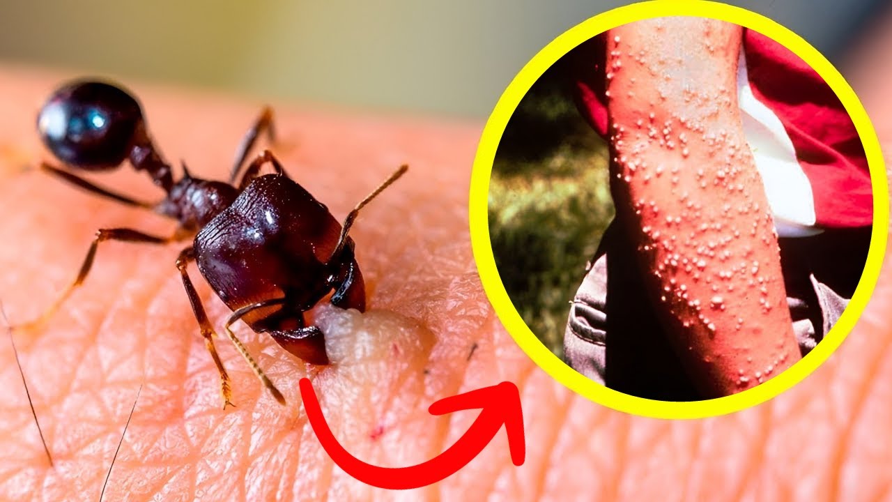 The 10 most dangerous insects in the world You can't ignore! - YouTube