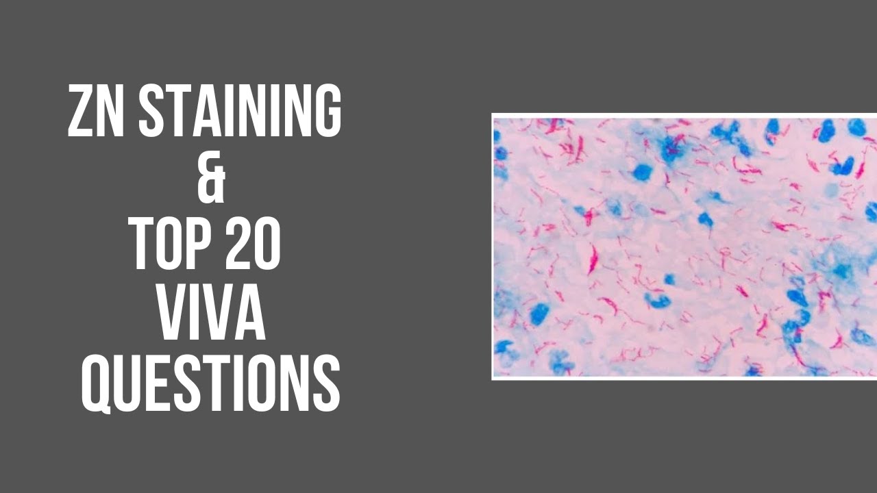 ZN staining / Acid Fast staining. Acid fast organisms with all possible ...