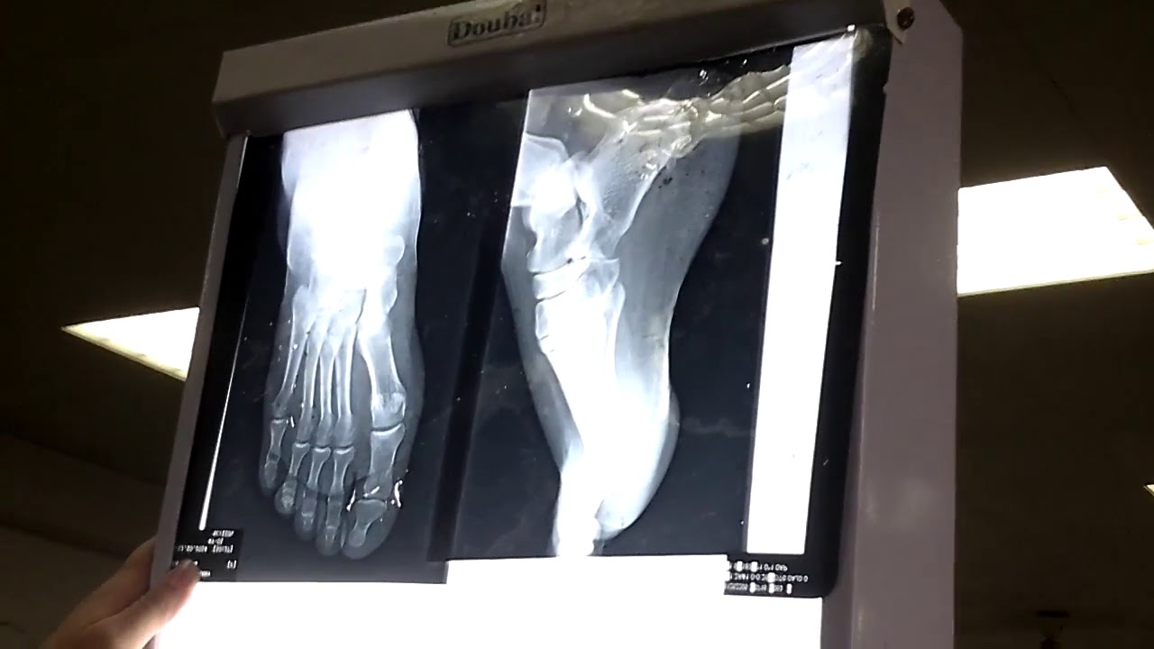 Practical Forensic X ray Part 2 - YouTube