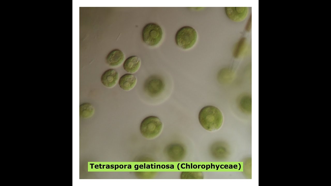 Tetraspora gelatinosa - řasa i mikroekosystém/algae and microecosystem ...