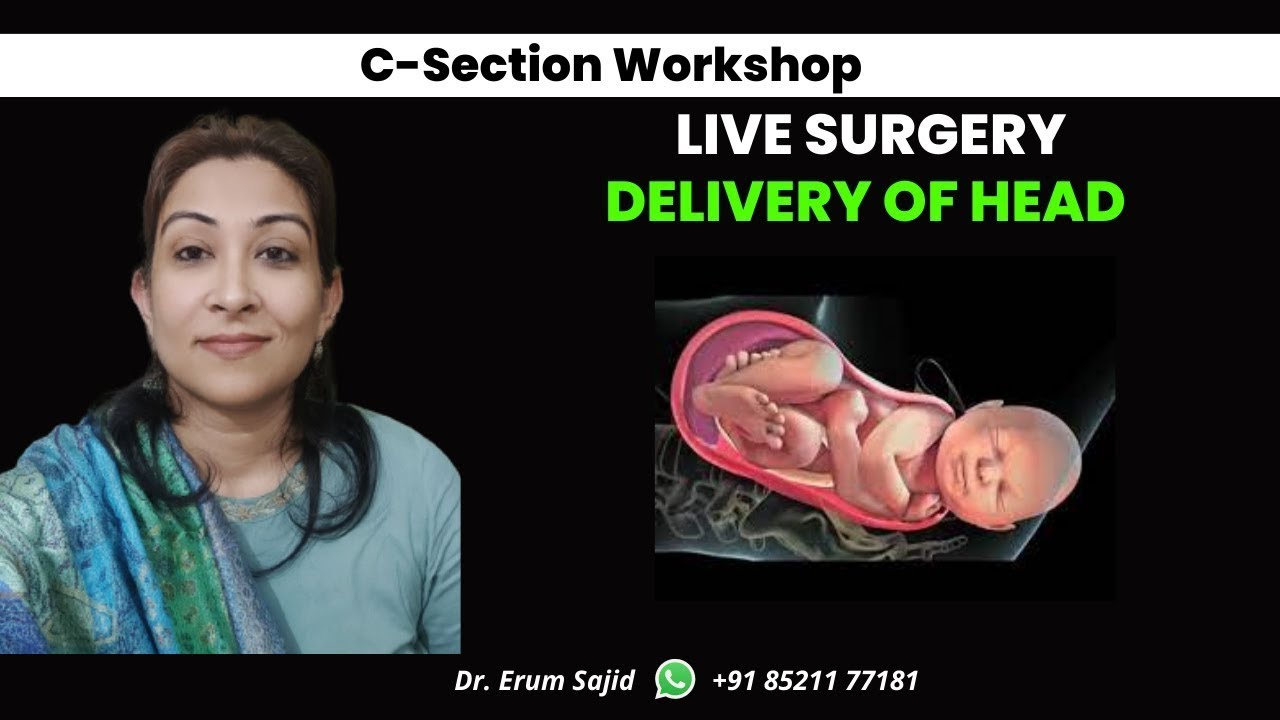 Live Surgery Delivery of head|C-section Workshop| Erum's DNB App for ...