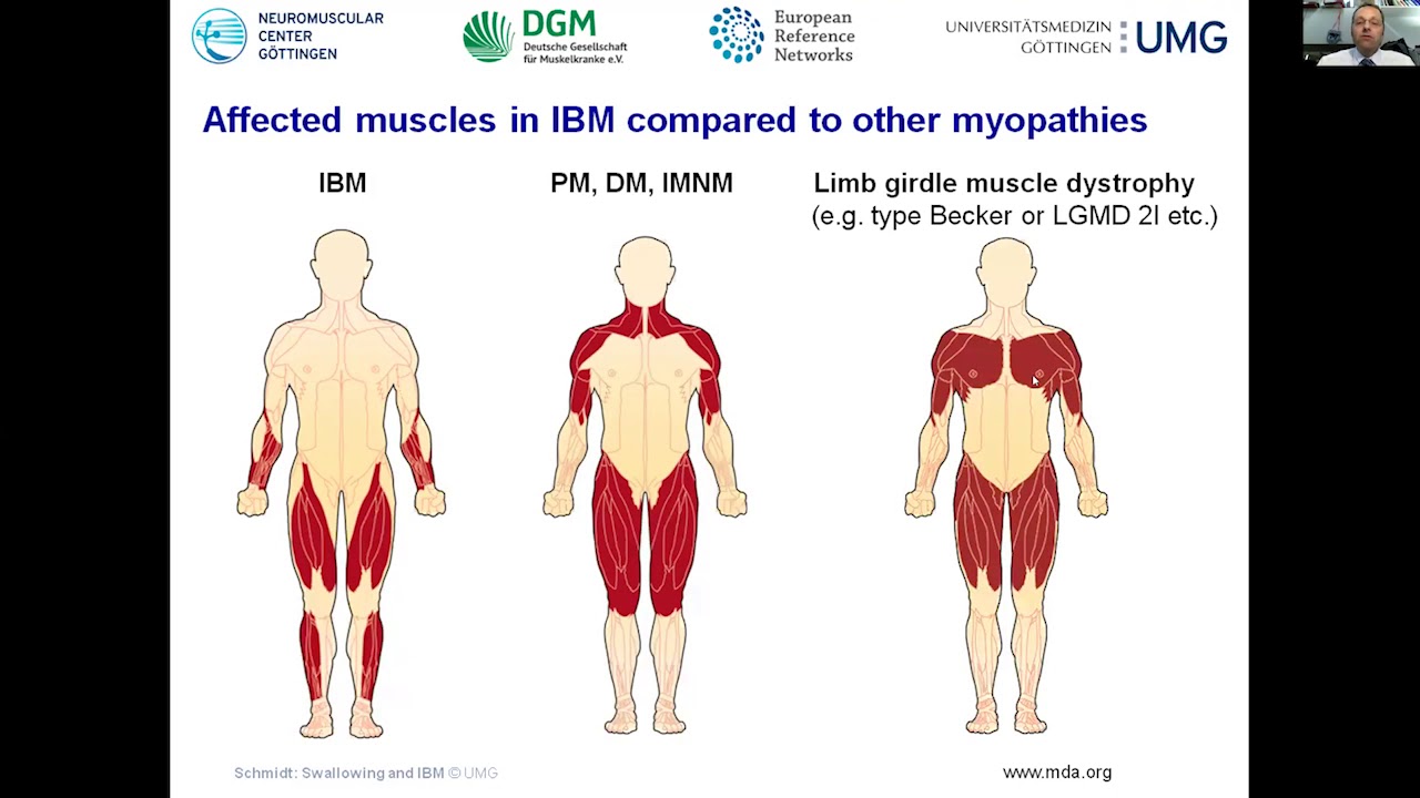 MDA Engage IBM Virtual Symposium 4 22 - YouTube