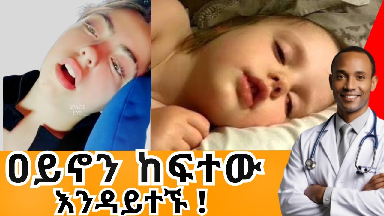 ዐይንን ከፍቶ መተኛት የሚያመጣቸው ከባባድ ችግሮች | መታወቅ ያለባቸው | Nocturnal Lagophthalmos ...