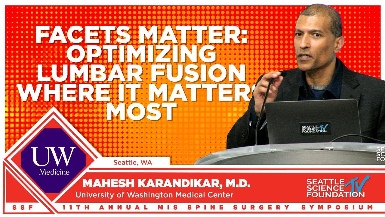Facets Matter : Optimizing Lumbar Fusion Where it Matters Most - Mahesh ...