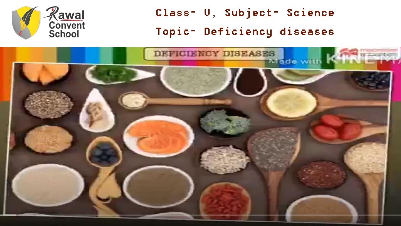 Class- V, Subject- Science, Topic- Deficiency diseases, RAWAL CONVENT ...