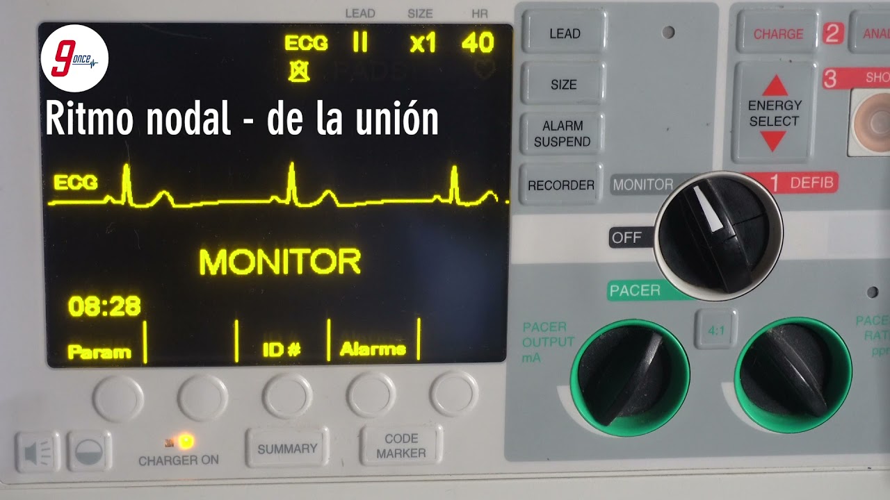 Ritmos cardíacos ritmo nodal o de la unión - YouTube