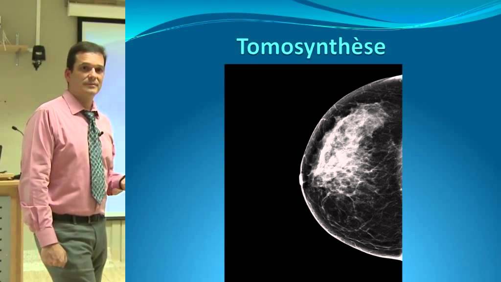 Mammographie 3D/Tomosynthèse - YouTube