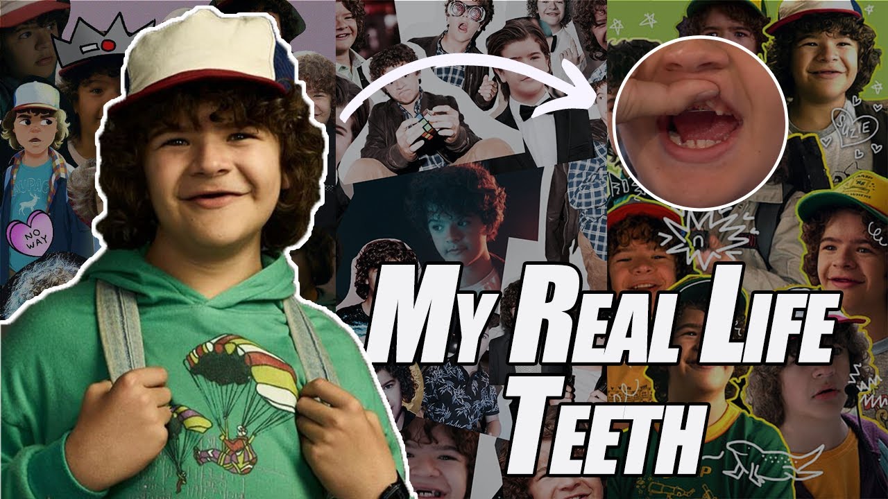 Dustin Henderson Teeth in Real Life| Gaten Matarazzo Teeth disease ...