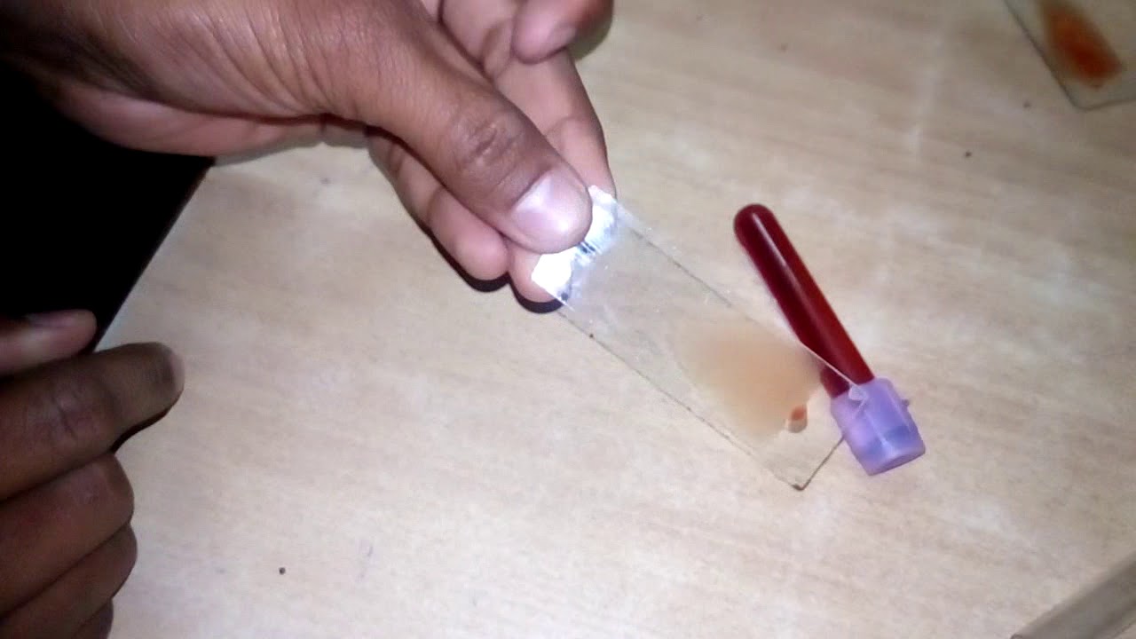 PBF - Peripheral Blood Film - YouTube