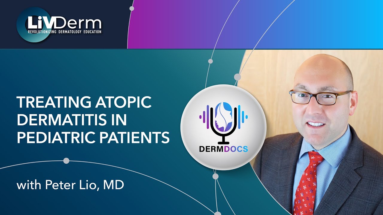 DermDocs Podcast | Treating Atopic Dermatitis in Pediatric Patients ...