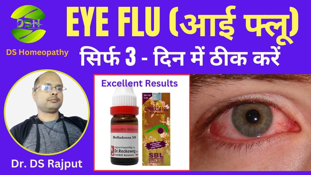 Eye Flu Treatment II Eye Flu Se Kaise Bache| Homeopathic Medicine for ...