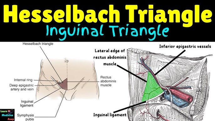 Inguinal Triangle Definition Inguinal Canal