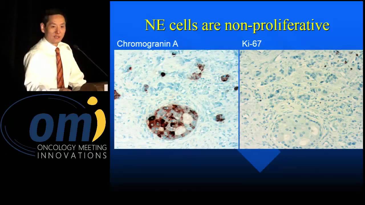Biology of neuroendocrine differentiation - Jiaoti Huang - YouTube