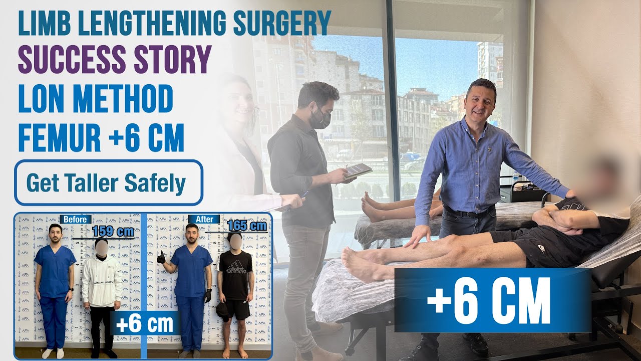 cosmetic-limb-lengthening-lon-method-femur-6-cm-youtube