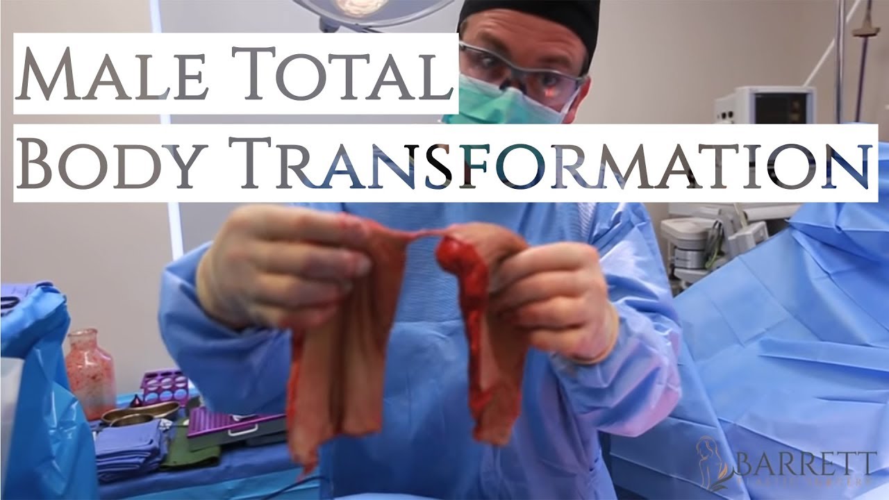 Male Total Body Transformation - Male Plastic Surgery - YouTube