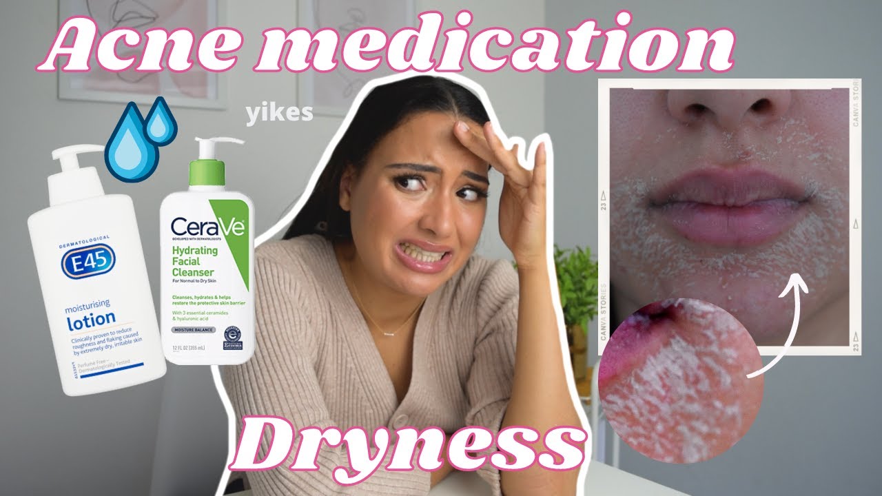 HOW TO FIGHT ACNE MEDICATION DRYNESS |DRY SKIN FROM TRETINOIN, BENZOYL ...