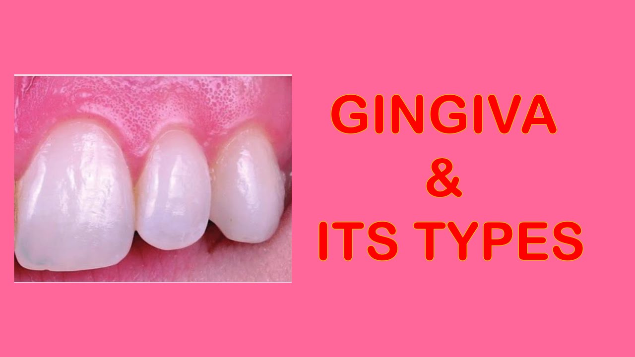 Types of Gingiva & Their Importance in Oral Health - YouTube