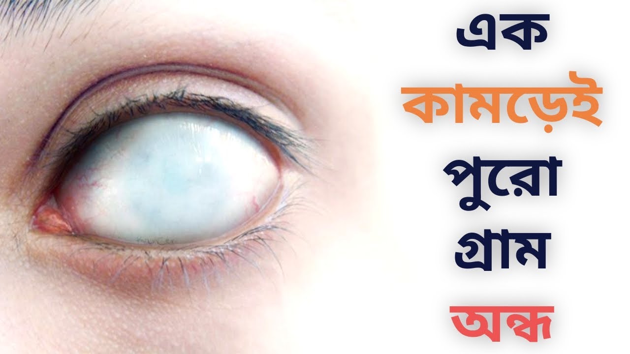 অন্ধ গ্রাম টিলটেপেক, blind village of tiltepec, akash patal - YouTube